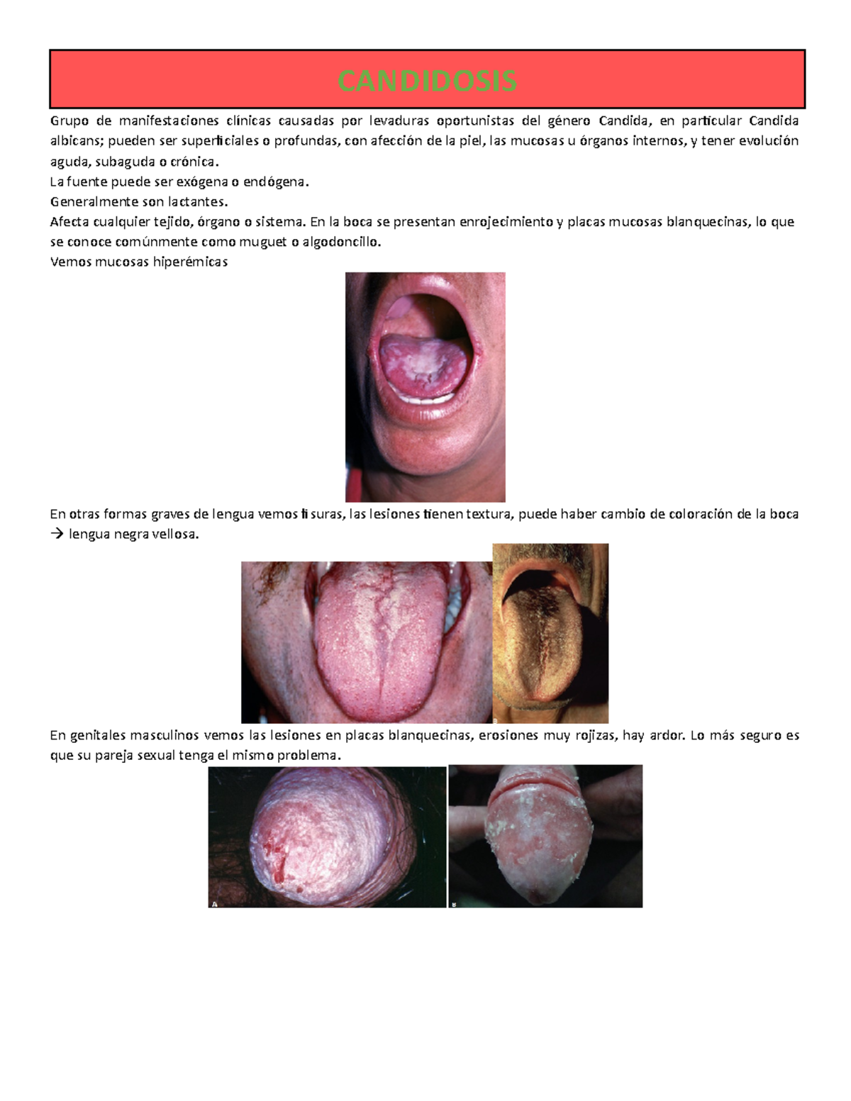 Candidosis - Apunte - Grupo de manifestaciones clínicas causadas por ...