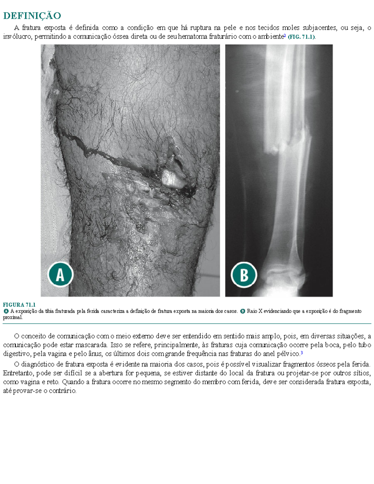 Tutoria Fratura - Resumo Ortopedia y Traumatología - DEFINIÇÃO A ...