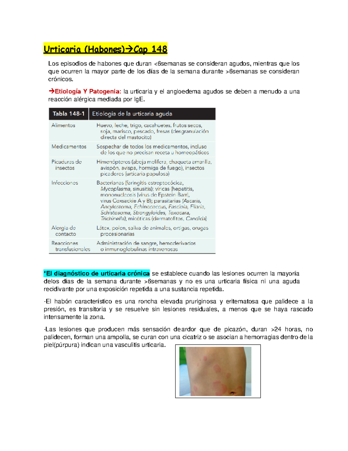 R-cap 148-Urticaria - urticaria en niños - Urticaria (Habones) Cap 148 ...