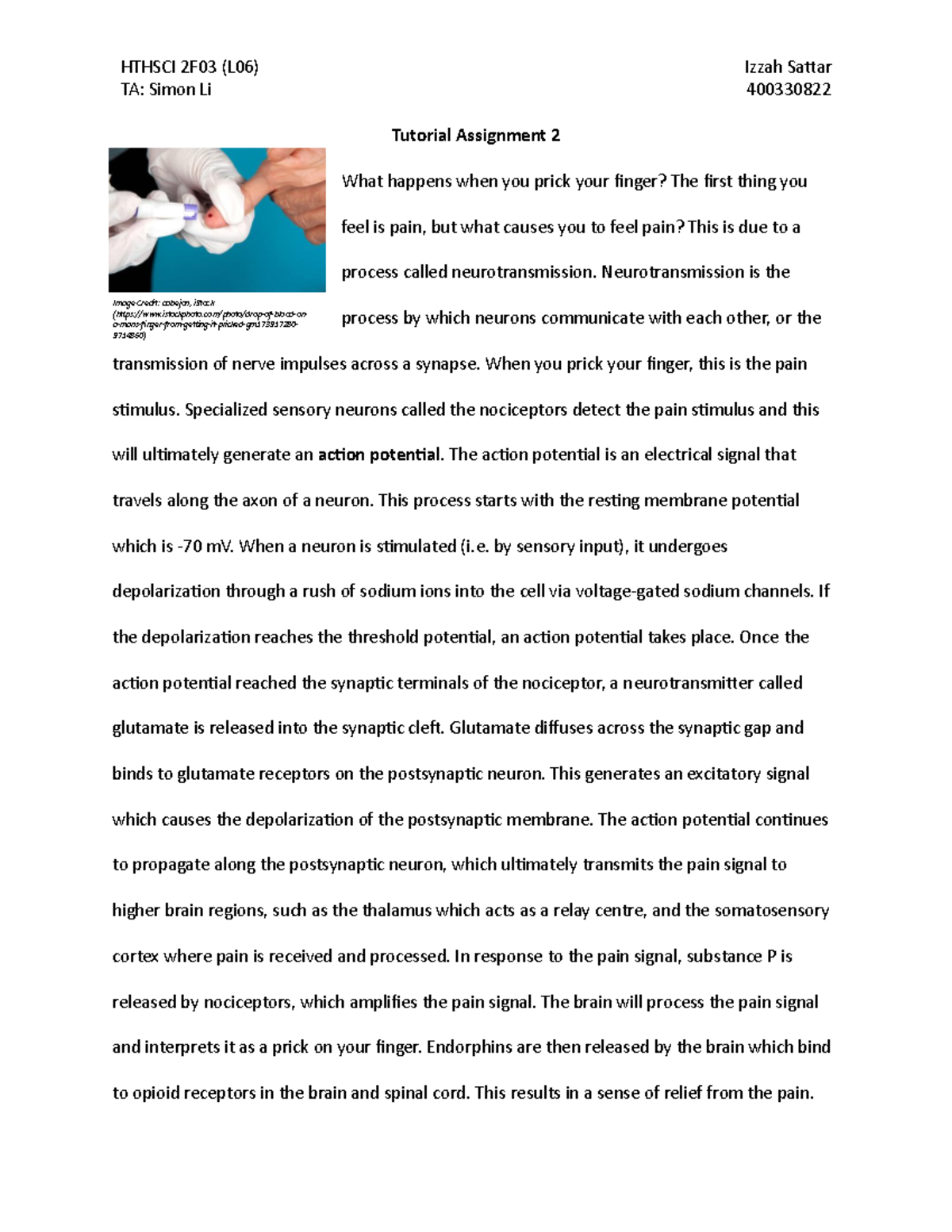 Hthsci 2F03 Tutorial Assignment 2 - HTHSCI 2F03 (L06) TA: Simon Li Izzah Sattar 400330822 ...