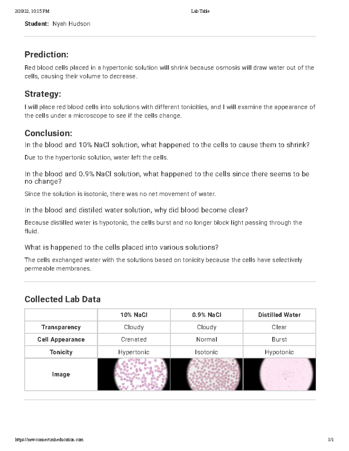 Osmosis - Tonicity in Red Blood Cells - 2/20/22, 10:15 PM Lab Table ...