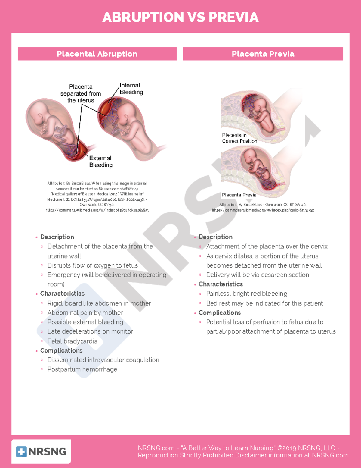Cs-ob-027-abruption vs previa - ABRUPTION VS PREVIA • Description o ...