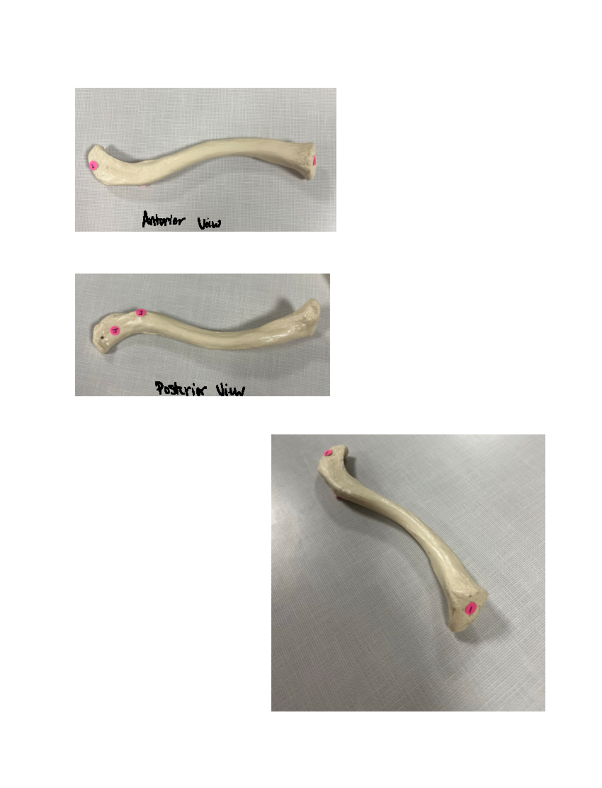 Lab 3 UE Bones - Summary Functional Anatomy - Anterior View Posterior ...