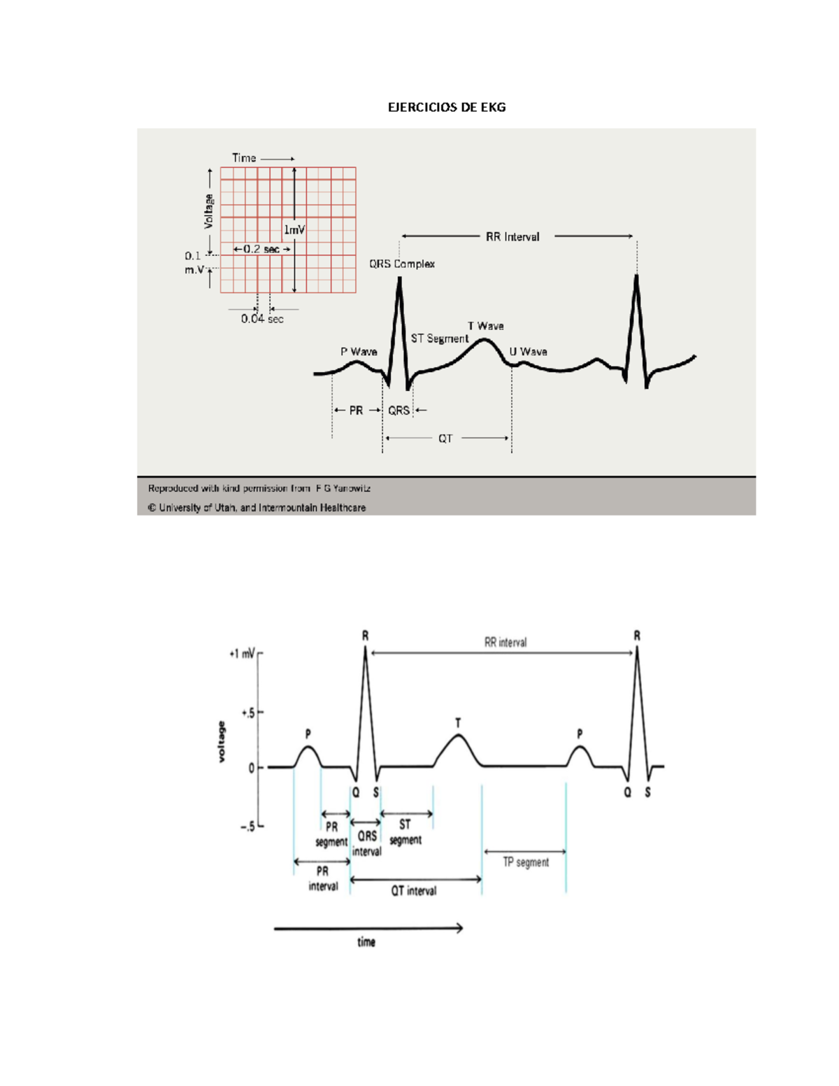 Ejercicios DE EKG - EJERCICIOS DE EKG Como medir la frecuencia cardiaca ...
