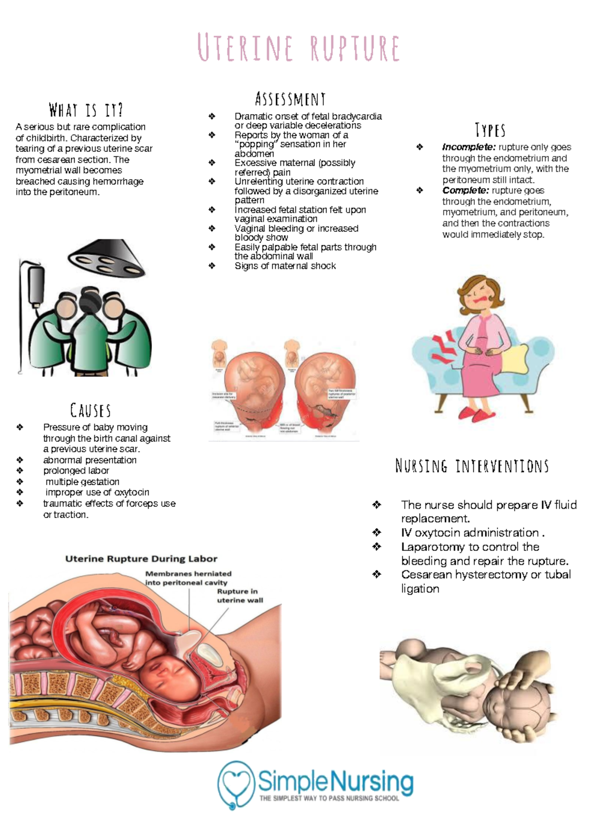 Uterine Rupture Notes Uterine Rupture Assessment Dramatic Onset Of