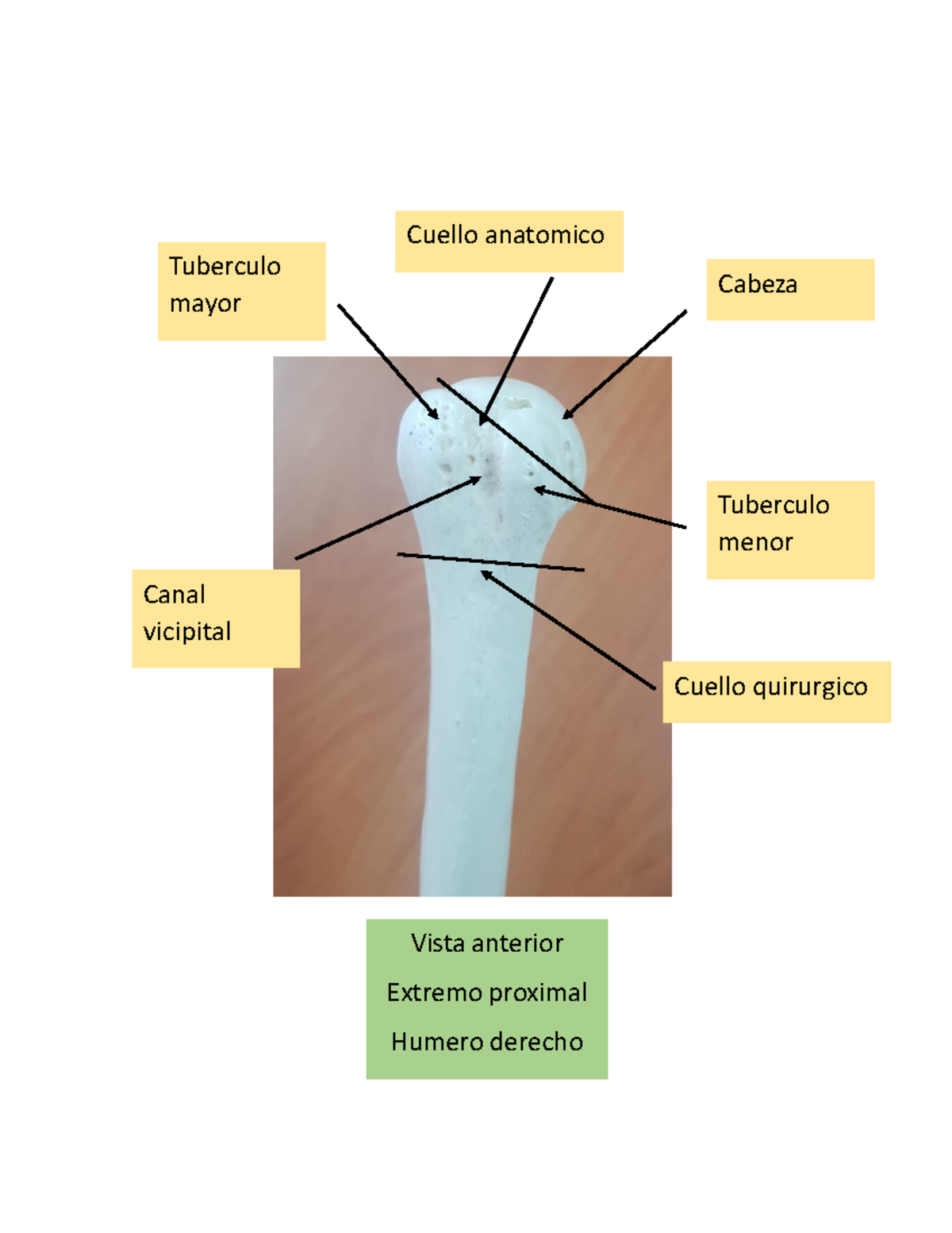 Huesos miembro superior - Tuberculo Cabeza mayor Tuberculo menor Canal ...