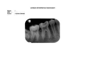 Interpretasi Radiografi kista odontogenik 1 - LEMBAR INTERPRETASI ...