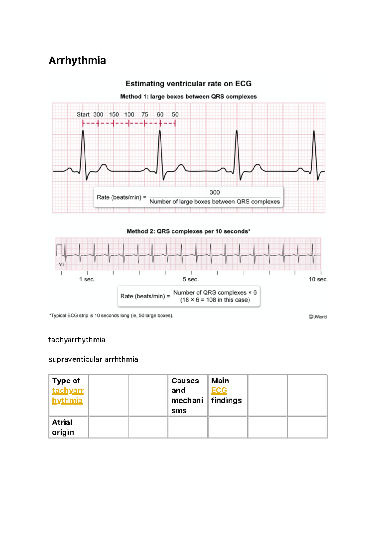 Arrhythmia - step 2 ck UW CARDIO - Arrhythmia tachyarrhythmia ...
