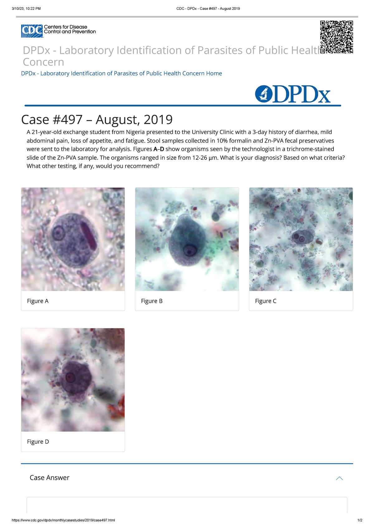 E - E.hystolytica CDC - 3/10/23, 10:22 PM CDC - DPDx - Case #497 ...