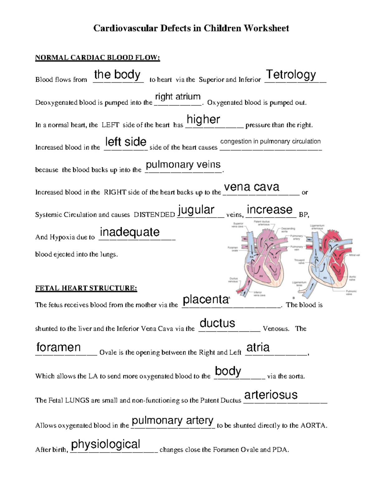 Cardiovascular Defects in Children Worksheet Fillable - Cardiovascular ...