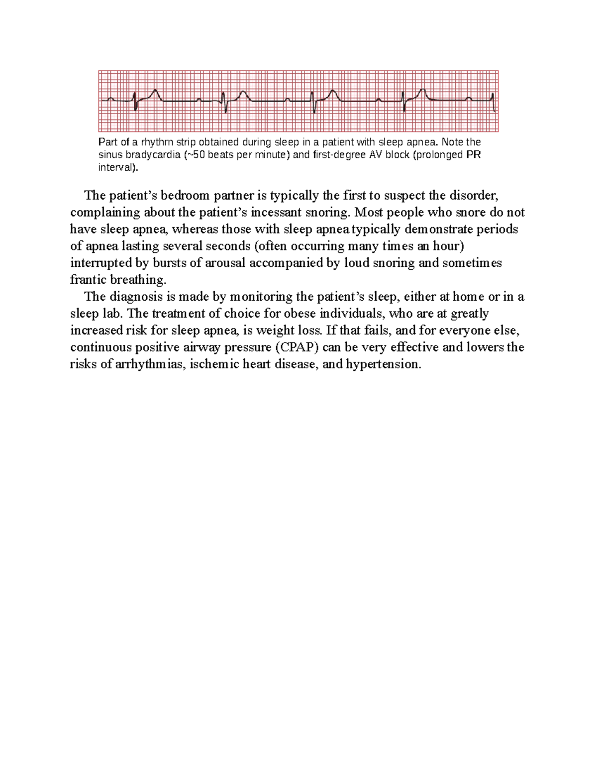 The only EKG-107 - The only EKG - Part of a rhythm strip obtained ...