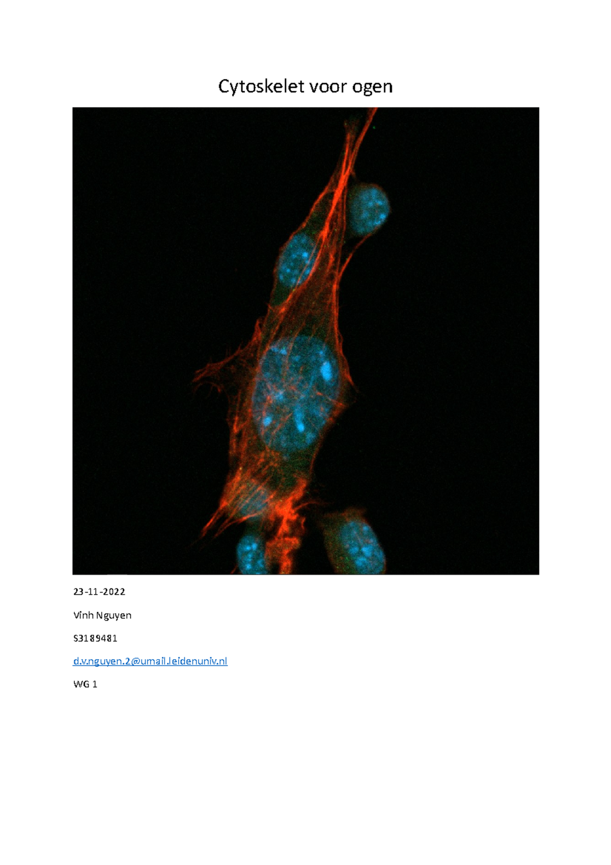 Cytoskelet voor ogen verslag - Cytoskelet voor ogen 23-11- Vinh Nguyen ...