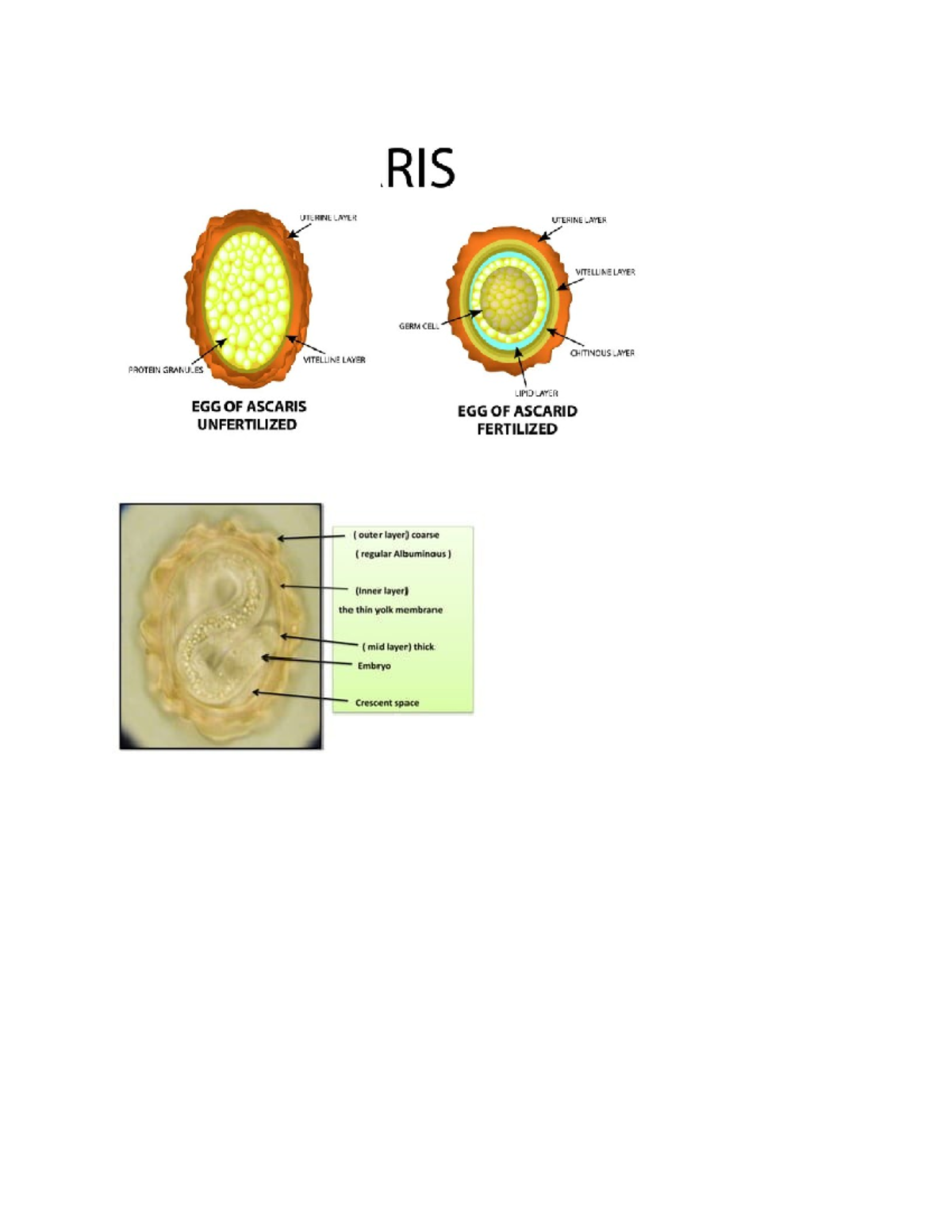 Ascaris - manual - RIS UTERINE LAYER UTERINE LAYER VITELLINE LAYER GERM ...